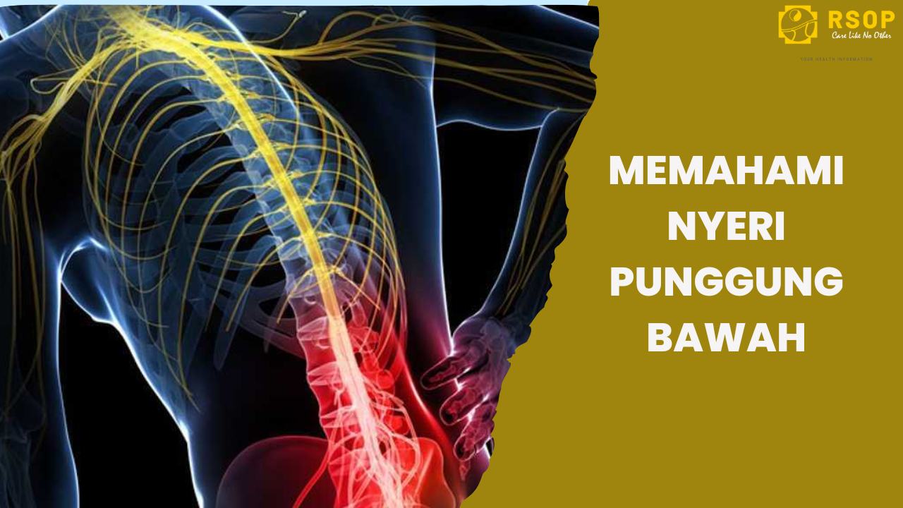 Mengenal Nyeri Punggung Bawah: Gejala, dan Cara Mengatasinya